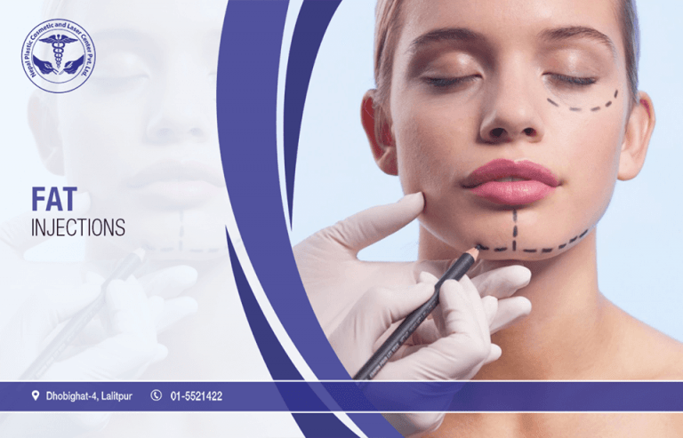 Fat Graft Injection Transfer in Nepal Kathmandu